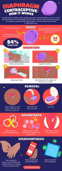 Diaphragm Contraceptive: Quick Highlights