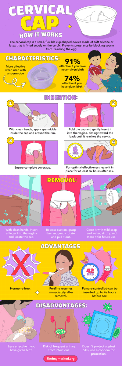 Cervical Cap: Quick Facts & Key Highlights